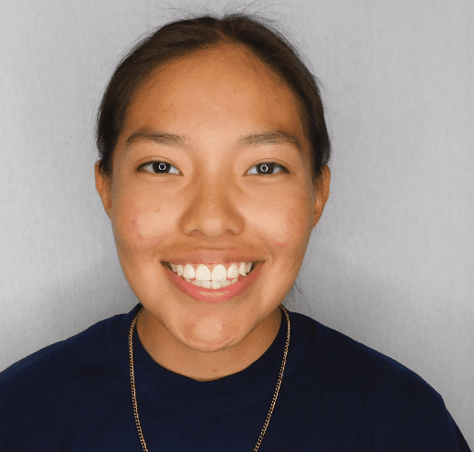 Why Us - Four Corners Orthodontics & Dental | Farmington, NM
