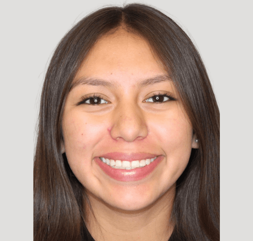 Why Us - Four Corners Orthodontics & Dental | Farmington, NM