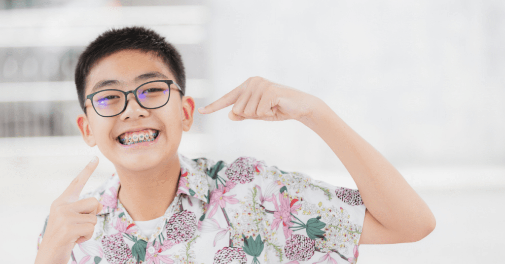 Pitts21 System of Braces - Four Corners Orthodontics & Dental